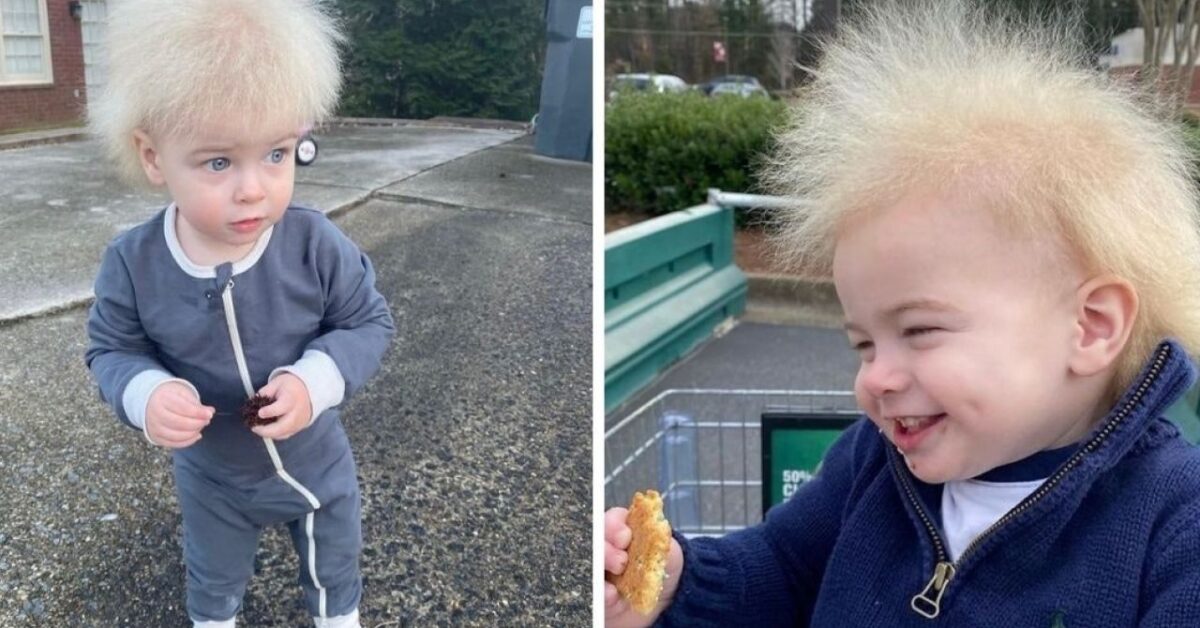 C'è un bambino che soffre di un particolare sindrome che gli impedisce ...